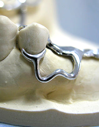 Partial Framework - Mbdentaire